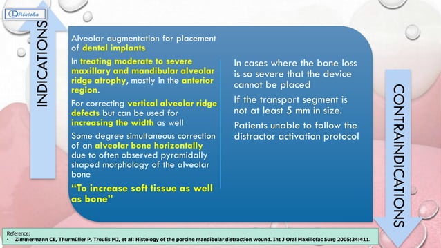 Ridge augmentation | PPTX