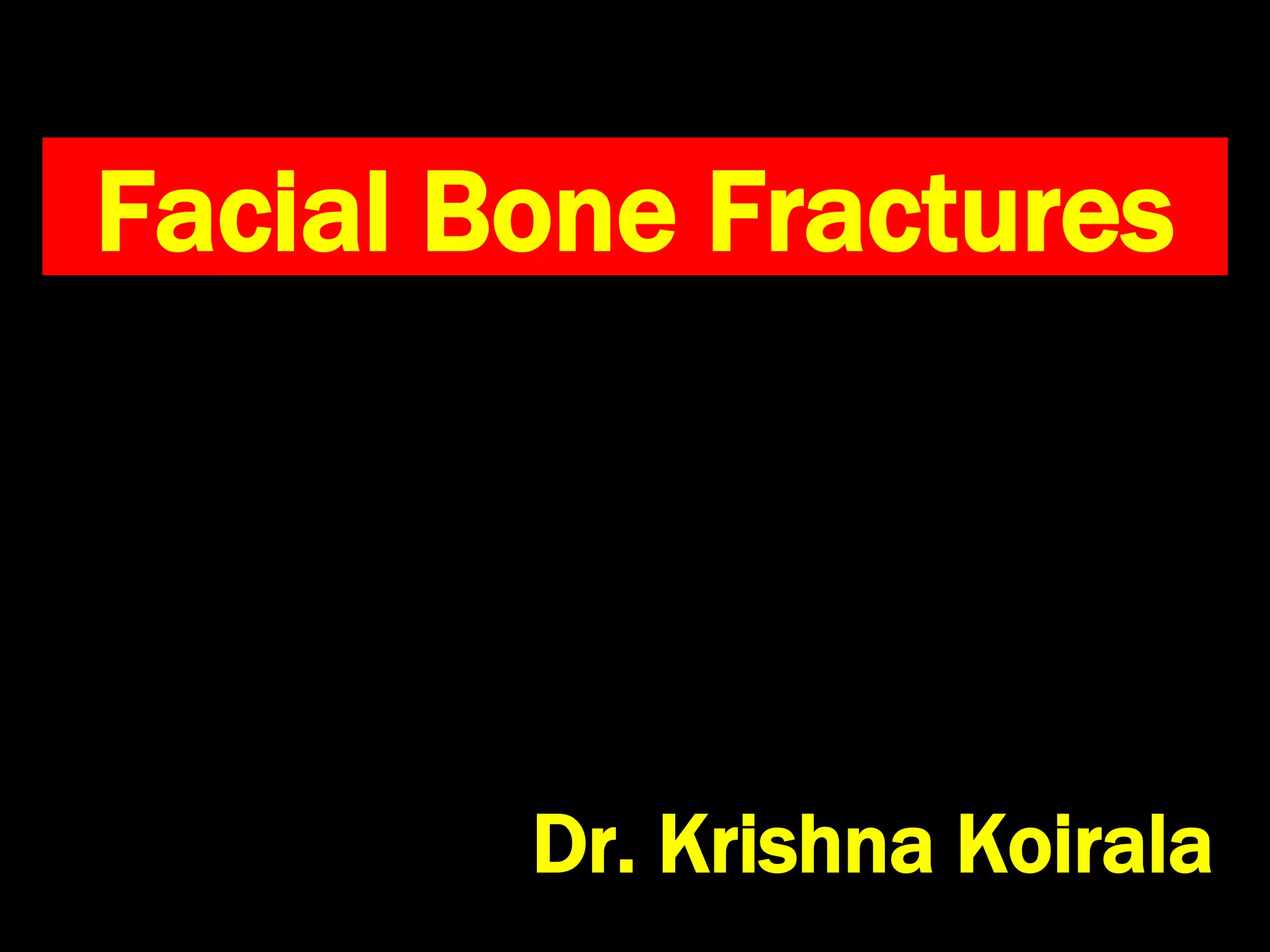 11. Facial Bone fractures.ppt