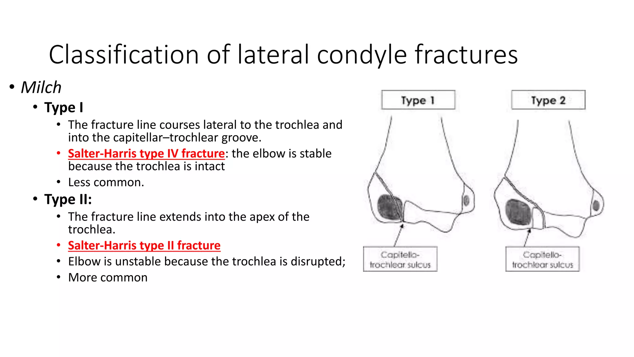 Fractures around elbow lateral condyle and intercondylar fractures | PPT
