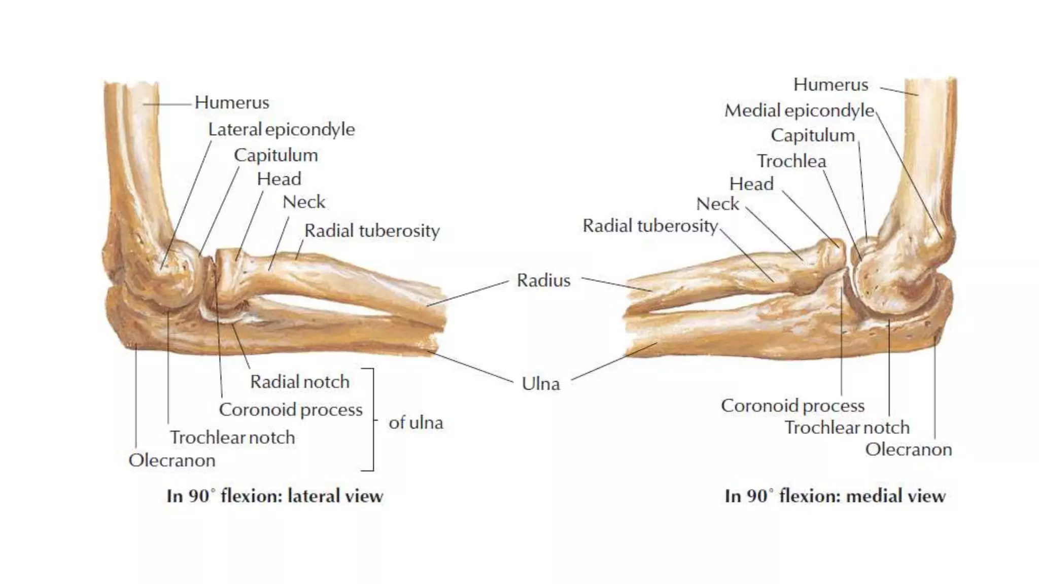 Fractures around elbow lateral condyle and intercondylar fractures | PPT