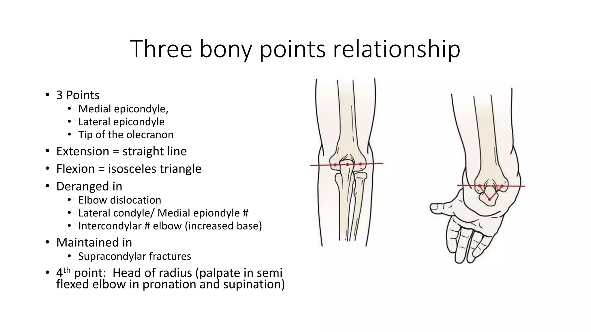 Fractures around elbow lateral condyle and intercondylar fractures | PPT