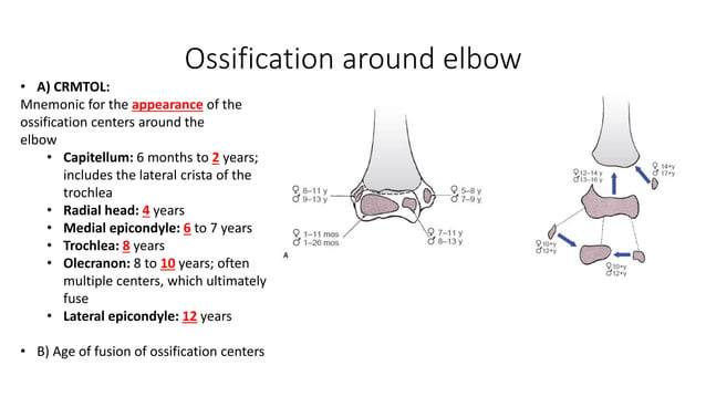 Fractures around elbow lateral condyle and intercondylar fractures | PPT