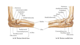 Fractures around elbow lateral condyle and intercondylar fractures | PPT
