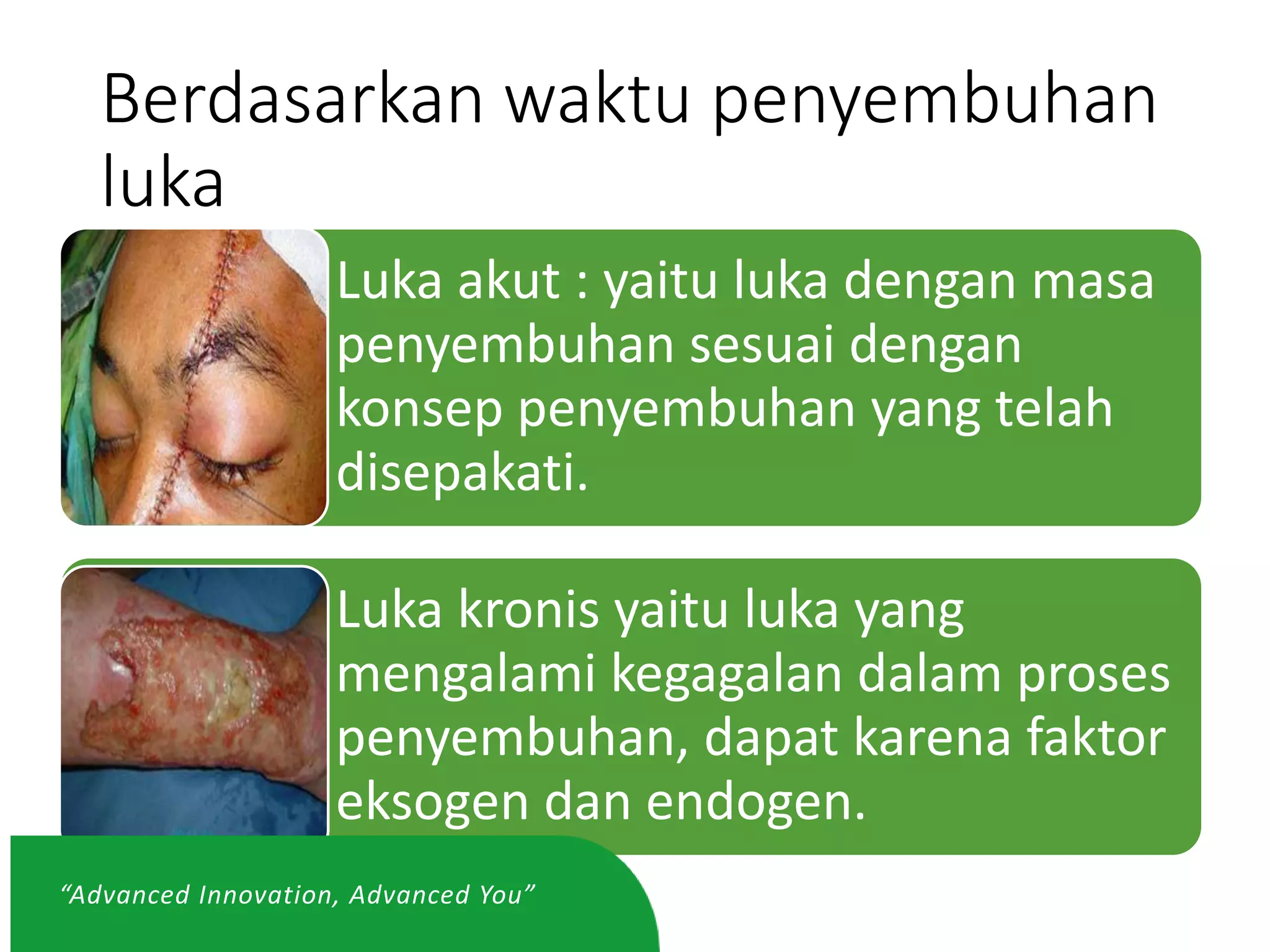 11. Perawatan Luka power point Ns.Heny-1.pptx