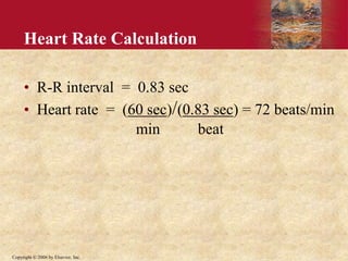 11.The normal electrocardiogram.ppt