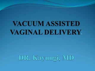 11. VACUUM DELIVERY.ppt