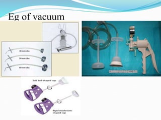 11. VACUUM DELIVERY.ppt