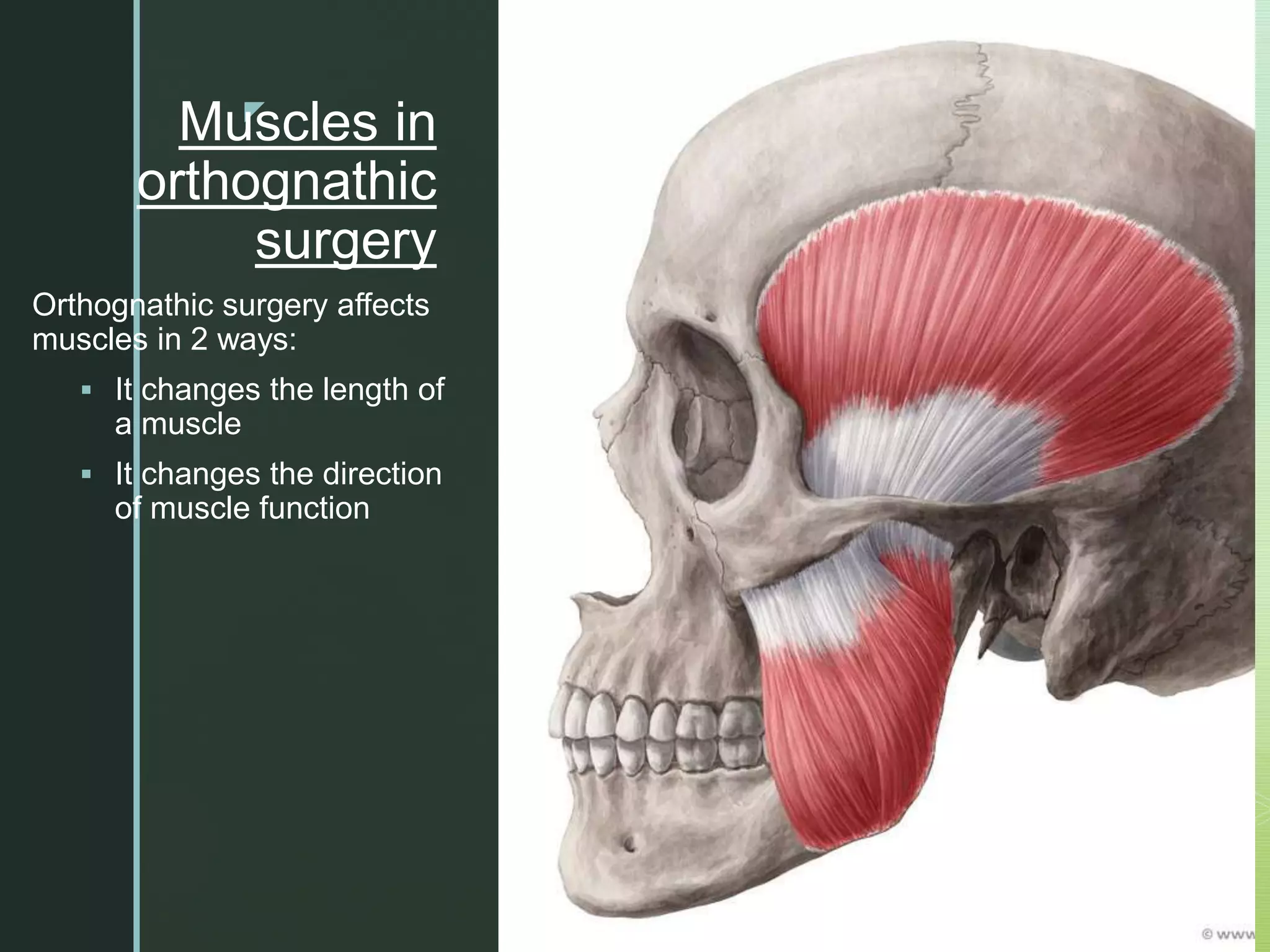 11. Mandibular osteotomies psk.pptx