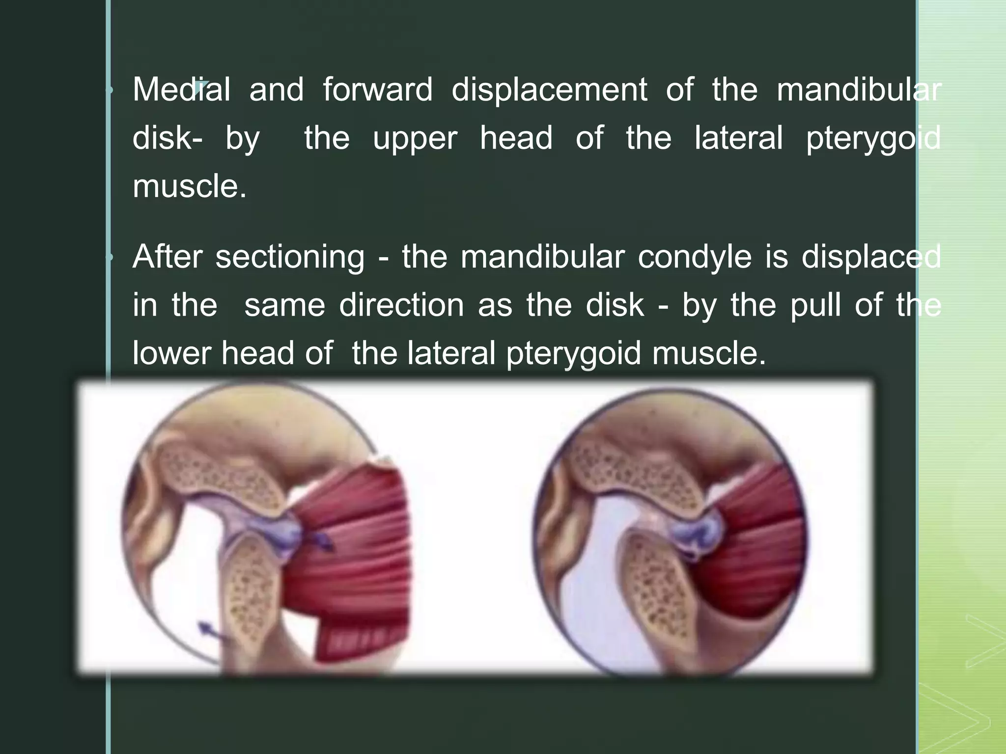 11. Mandibular osteotomies psk.pptx