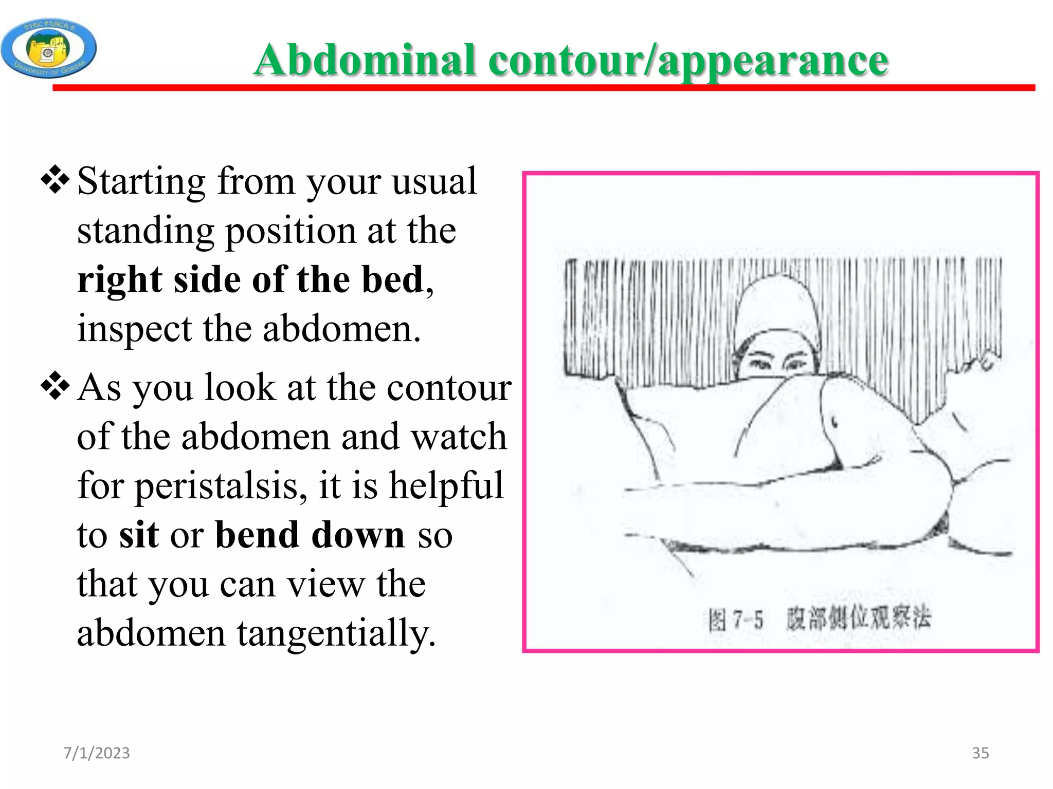 11. Final Abdominal Examination.ppt