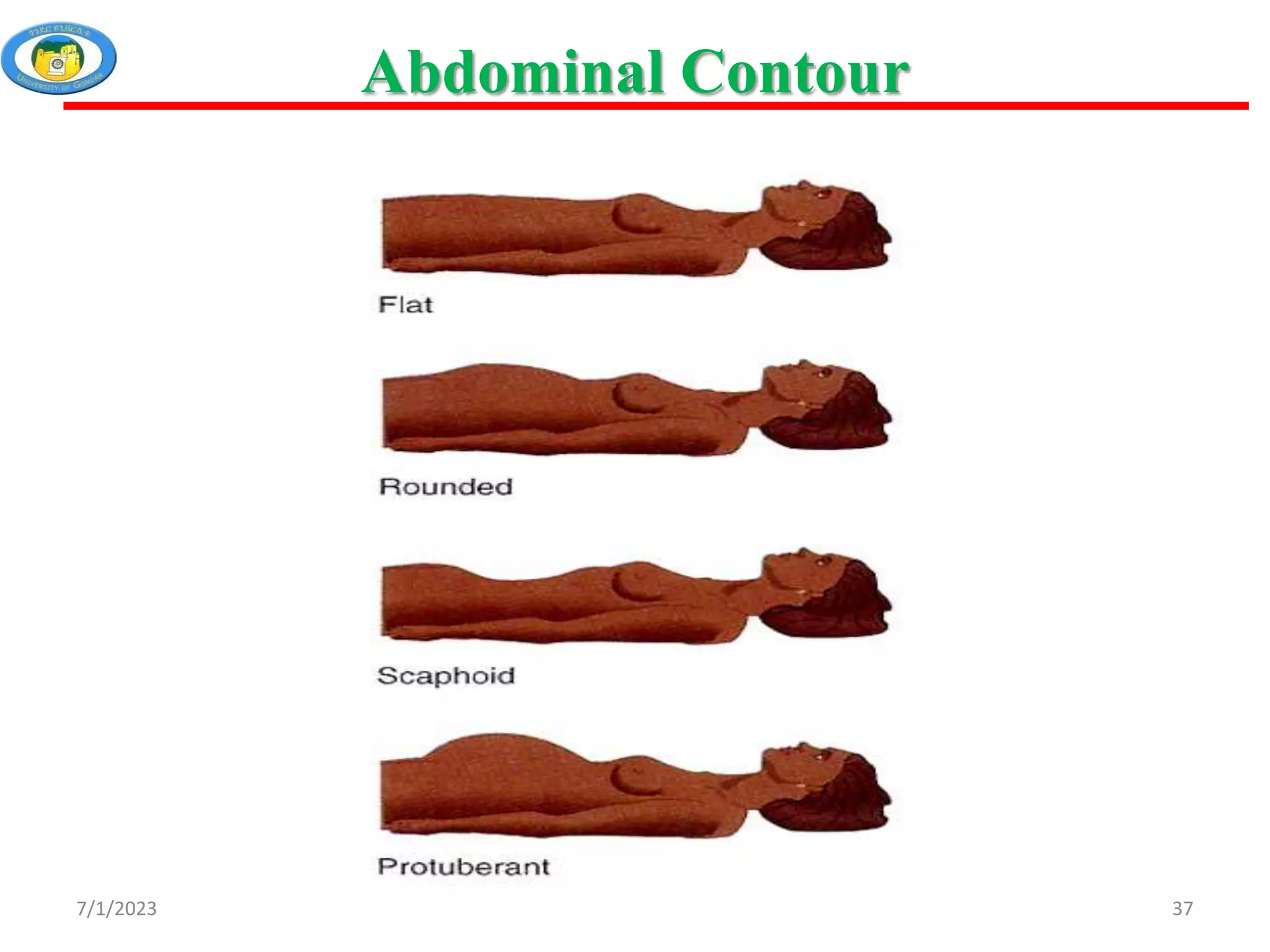 11. Final Abdominal Examination.ppt