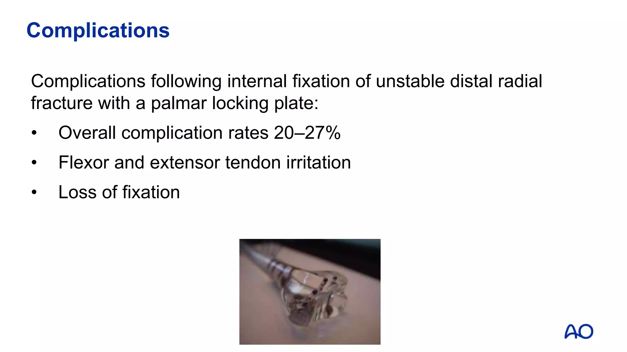 11. Distal radial fractures; management principles.pptx