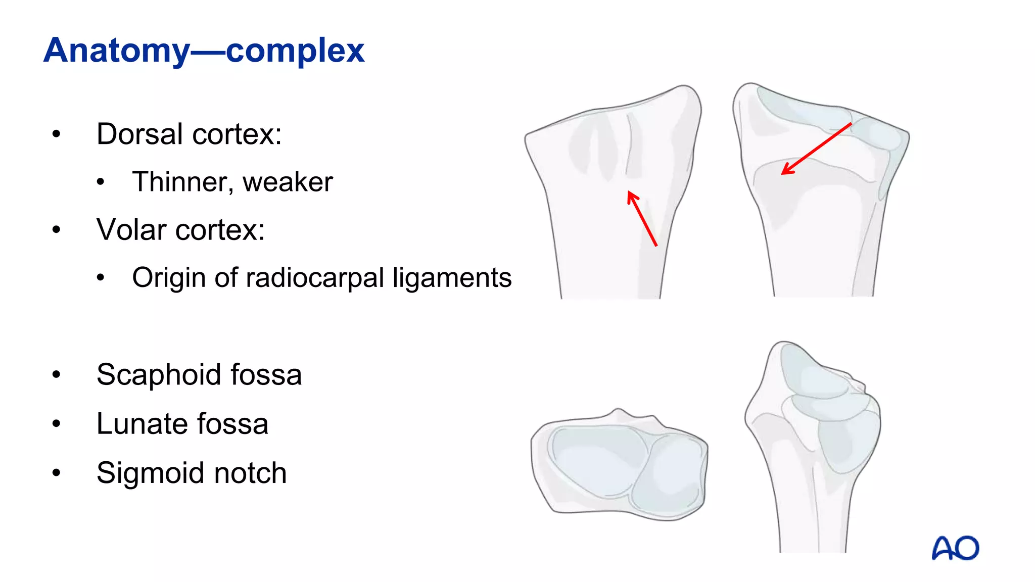 11. Distal radial fractures; management principles.pptx