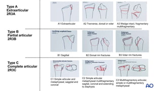 11. Distal radial fractures; management principles.pptx