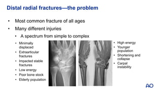 11. Distal radial fractures; management principles.pptx