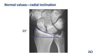 11. Distal radial fractures; management principles.pptx