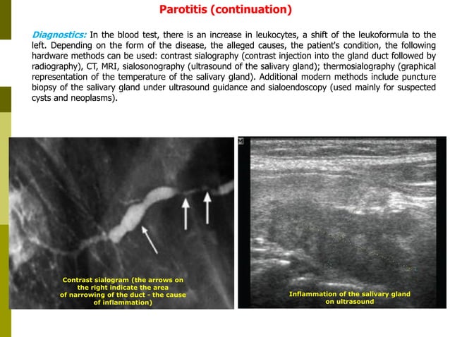 Inflammation of the lymph nodes, blood and lymph vessels. Inflammation ...