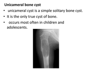 11. BONE NEOPLASMS in Medical Pathology.pptx