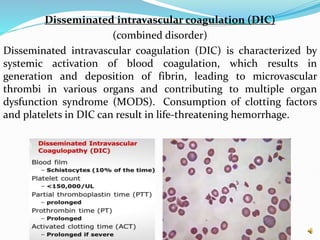 11.coagulation diseases hematology .pptx