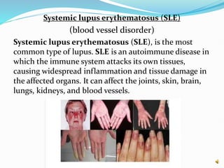 11.coagulation diseases hematology .pptx