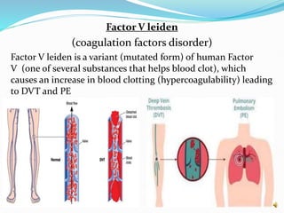 11.coagulation diseases hematology .pptx