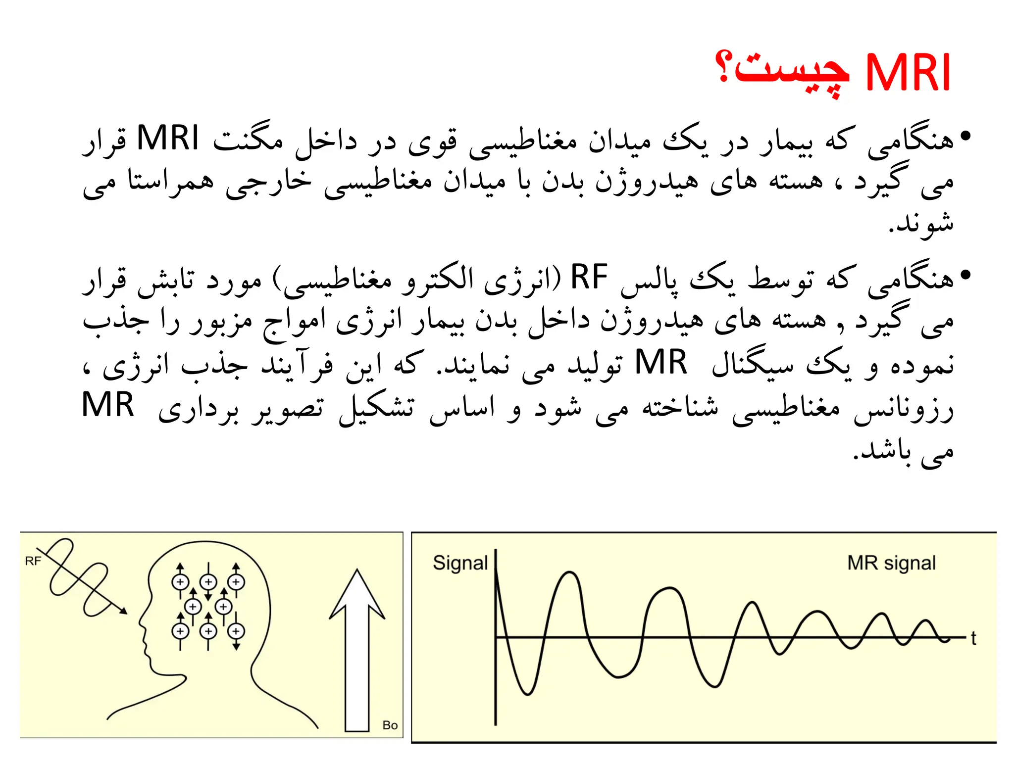 MRI Biomedical engineering Biomedical engineering Biomedical ...