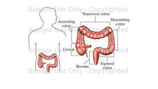 11. LARGE INTESTINE.ppt a brief description | PPT
