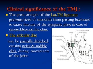 11. muscles o f mastication.ppt