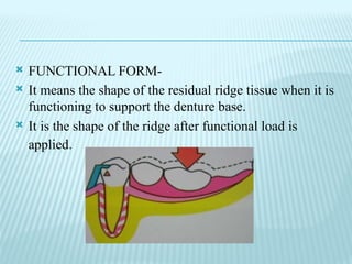 11.Special Impression Procedures For TooTH-Tissue-Supported removable ...