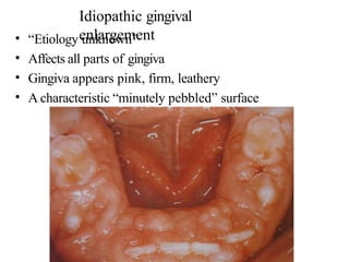 Types and classification of gingival enlargement | PPTX