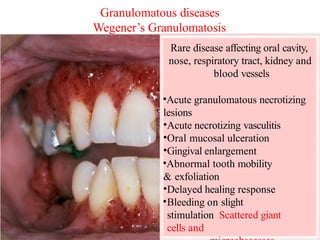 Types and classification of gingival enlargement | PPTX