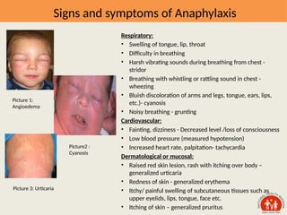 Adverse events following immunisation and its Management.pptx