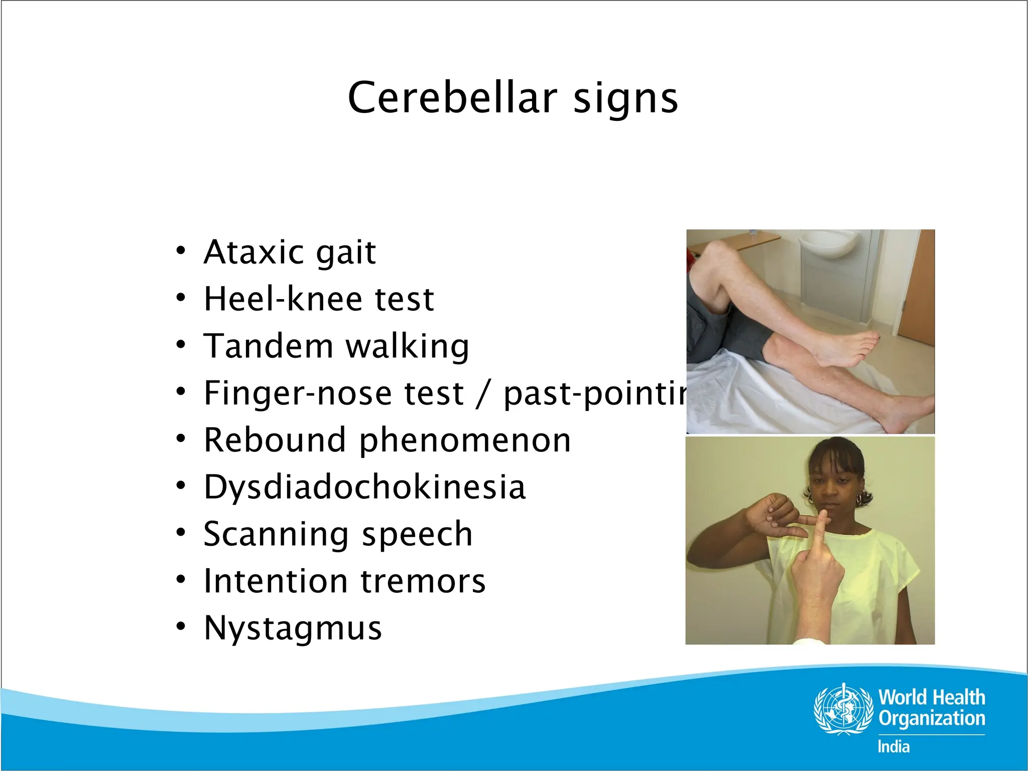 11. Acute Flaccid Paralysis – Differential Diagnoses.pptx
