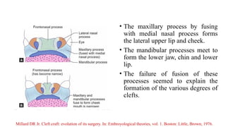 management of Cleft Lip, management of cleft lip and palate | PPTX