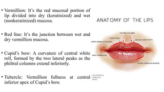 management of Cleft Lip, management of cleft lip and palate | PPTX
