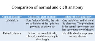 management of Cleft Lip, management of cleft lip and palate | PPTX