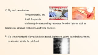 11.avulsion ppt.pptx trauma of anterior teeth | PPTX