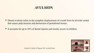 11.avulsion ppt.pptx trauma of anterior teeth | PPTX