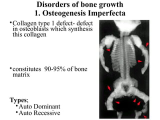 11. MUSCLE SKELETAL SYSTEM PATHOLOGY NOTES- | PPT