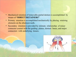 Direct Retainers in removable partial denture | PPTX