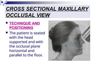 11. Occlusal radiography techniques.pptx