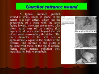 Comprehensive Analysis of Gunshot Damage and Forensic Ballistics | PPT