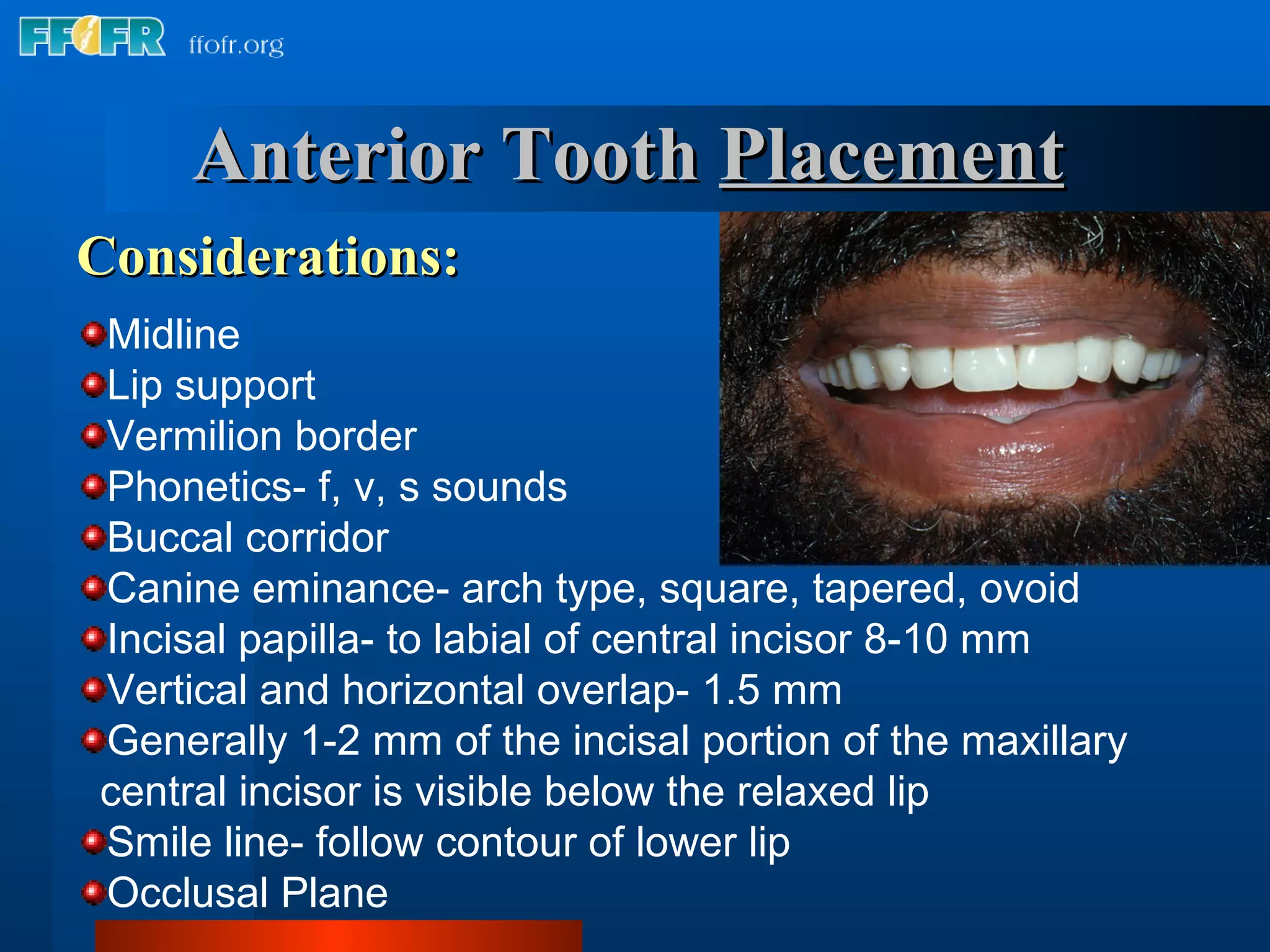 11.anterior tooth selection | PPT
