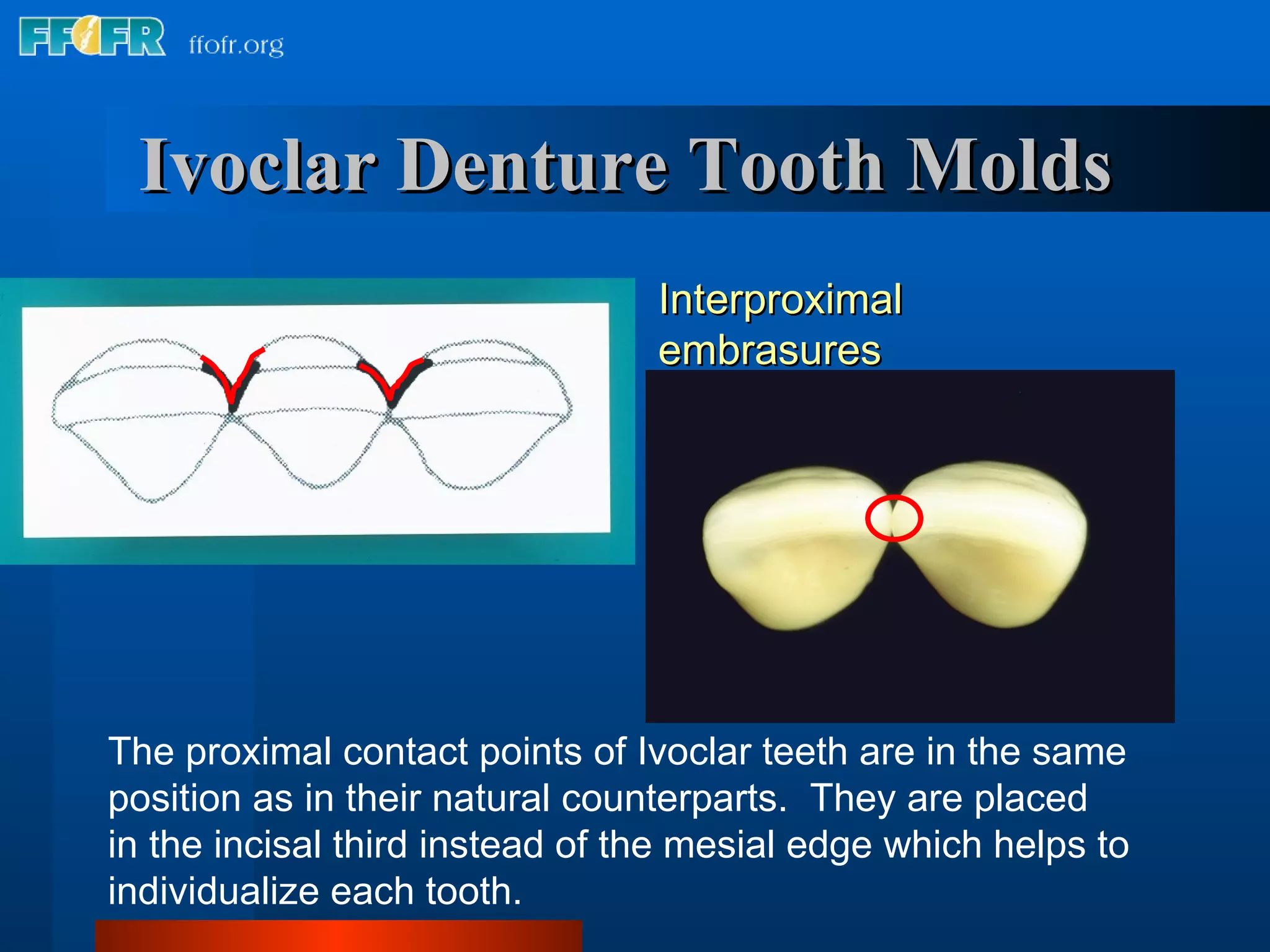 11.anterior tooth selection | PPT