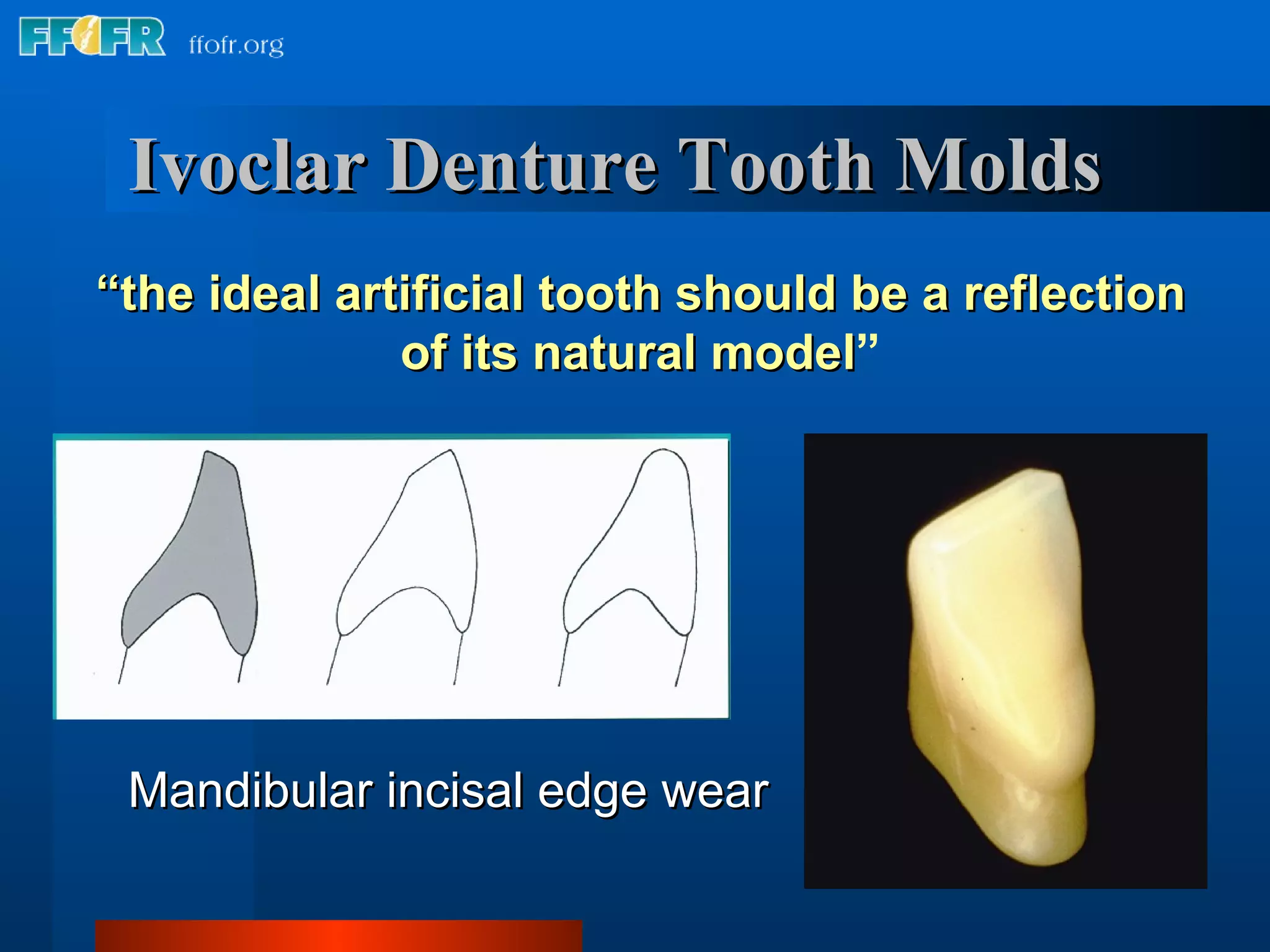 11.anterior tooth selection | PPT