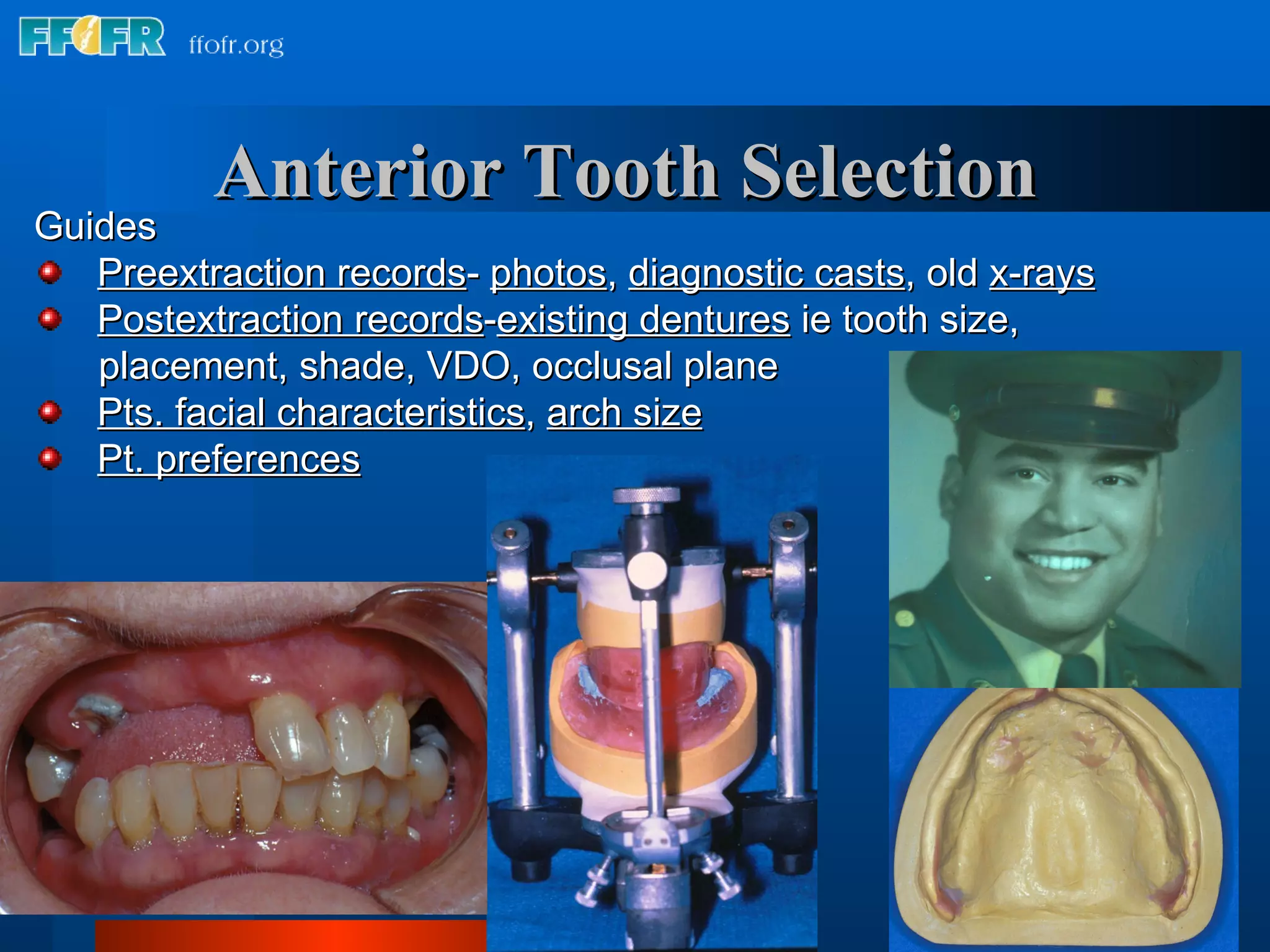 11.anterior tooth selection | PPT
