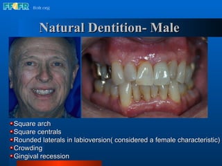 11.anterior tooth selection | PPT