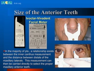 11.anterior tooth selection | PPT