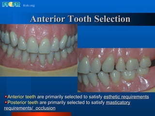 Posterior Anterior Teeth