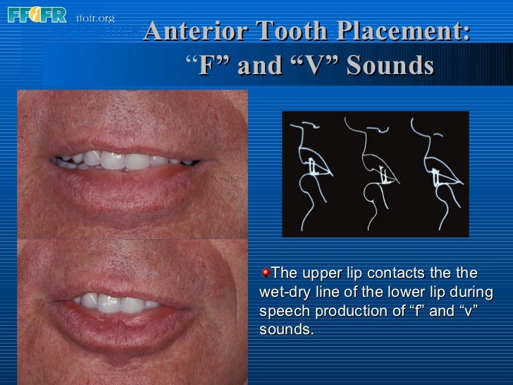 11.anterior tooth selection